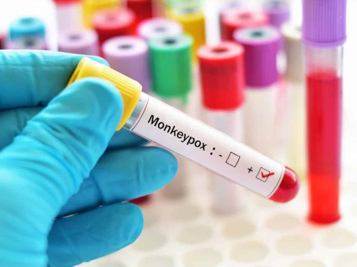 All Virus Tests - Marylebone Diagnostic Centre