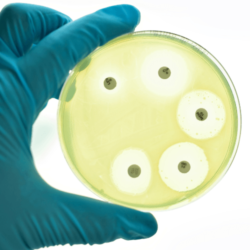 Mrsa Test How to Test for MRSA: 8 Steps (with Pictures) - wikiHow