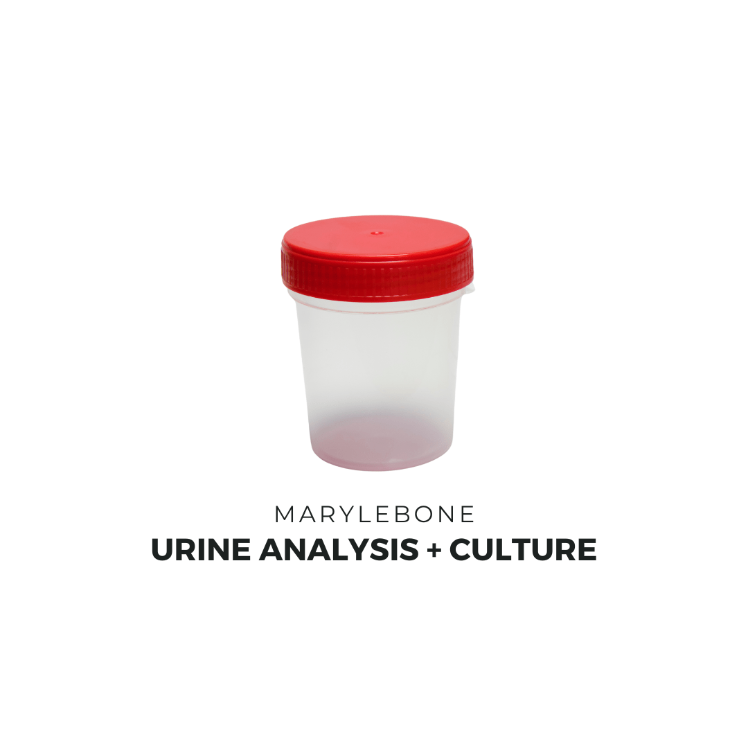 Urine analysis and Culture - Marylebone Diagnostic Centre