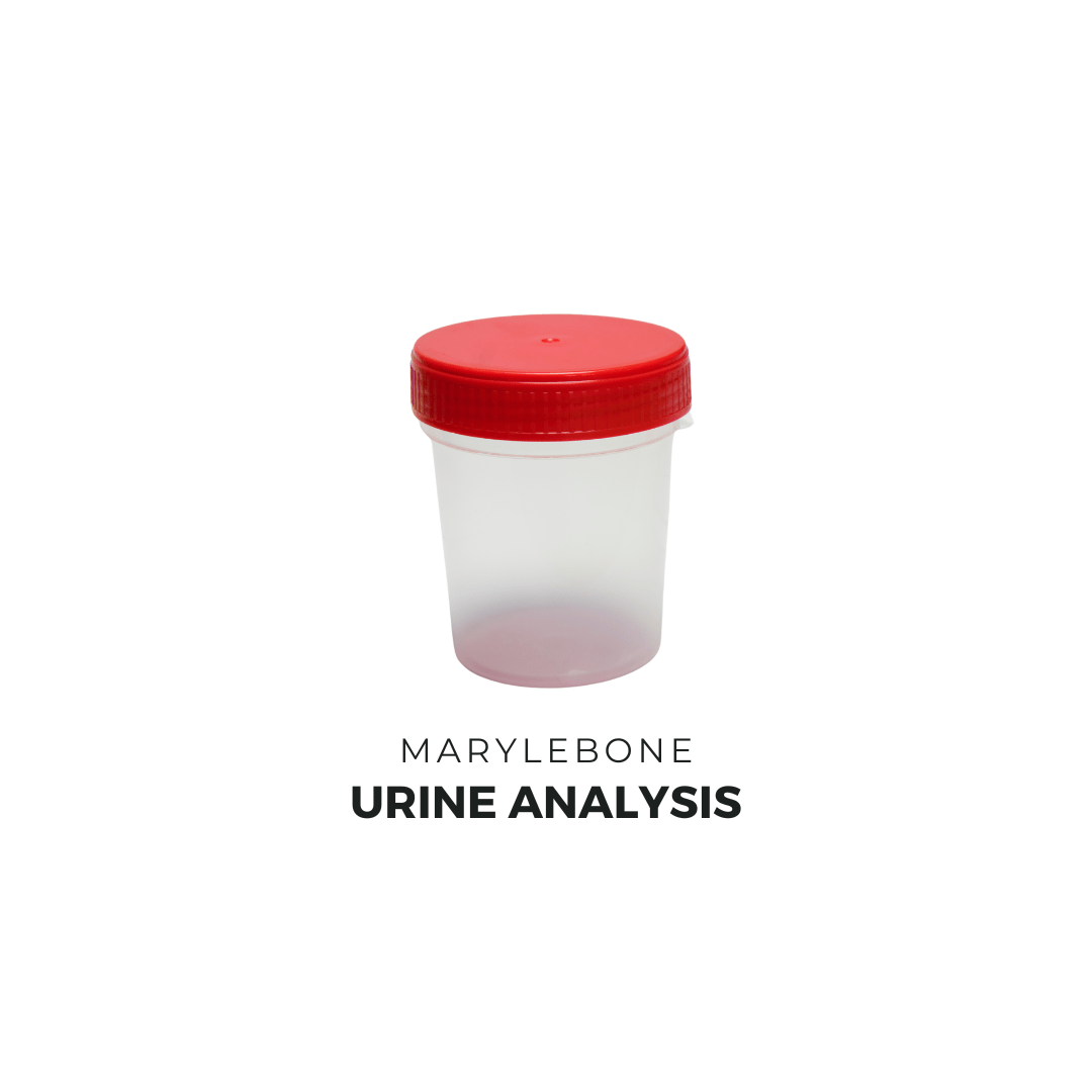 Urine Analysis - Marylebone Diagnostic Centre