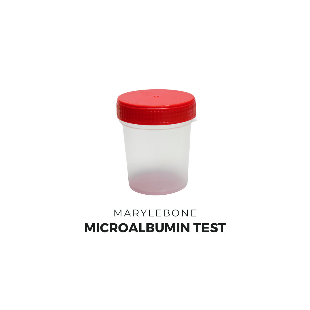 Microalbumin Test - Marylebone Diagnostic Centre