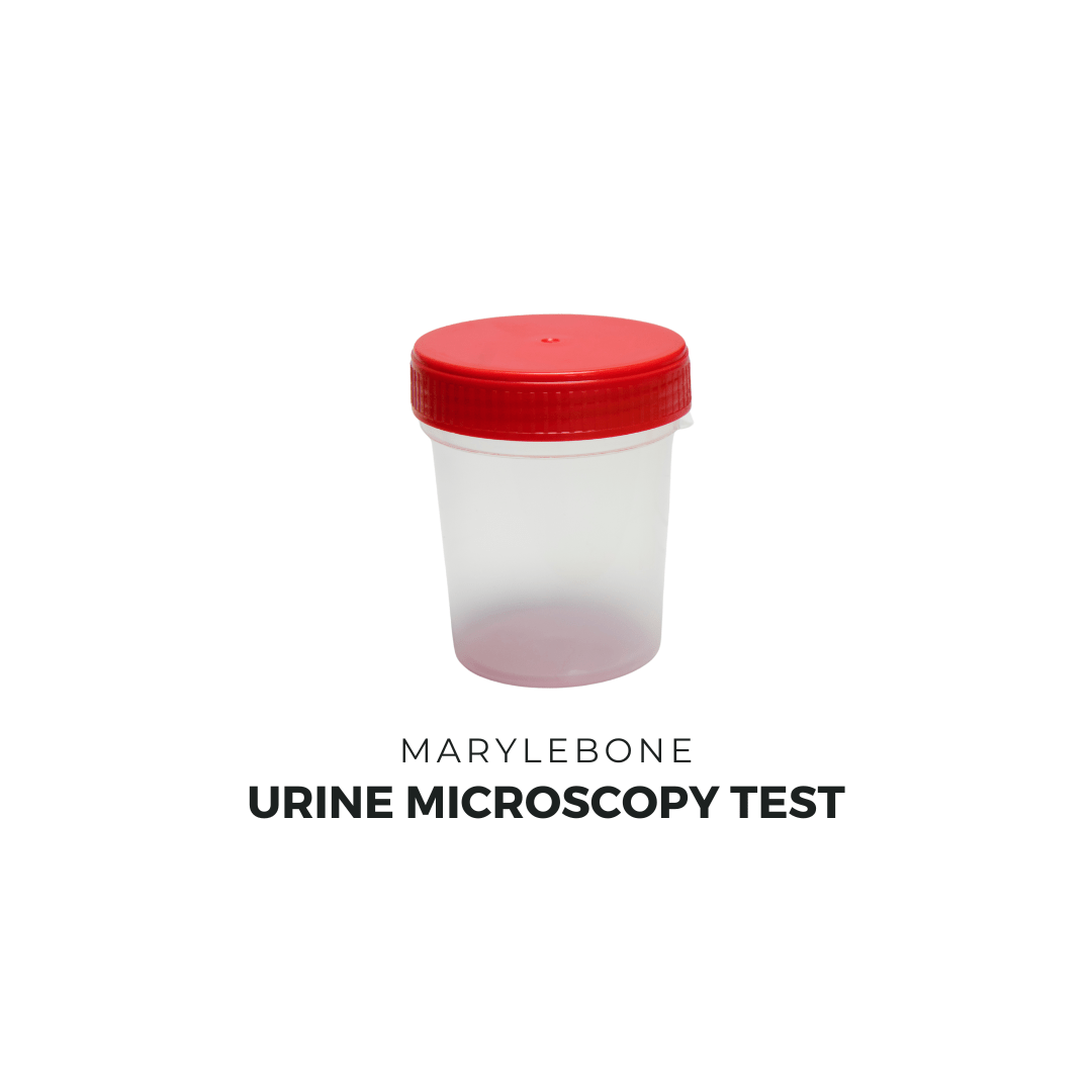 Urine Microscopy Test - Marylebone Diagnostic Centre