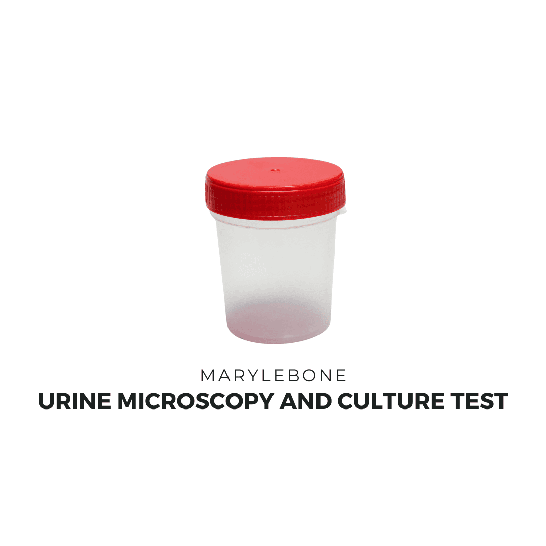Microscopy and Culture Test - Marylebone Diagnostic Centre