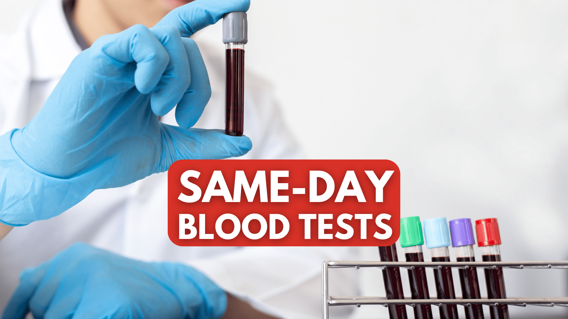 Same Day Blood Tests London – Fast, Private, and Reliable - Marylebone ...