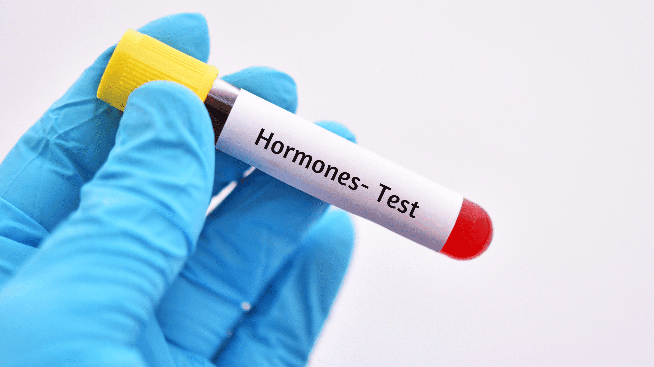 Hormone Blood Testing in Central London - Marylebone Diagnostic Centre