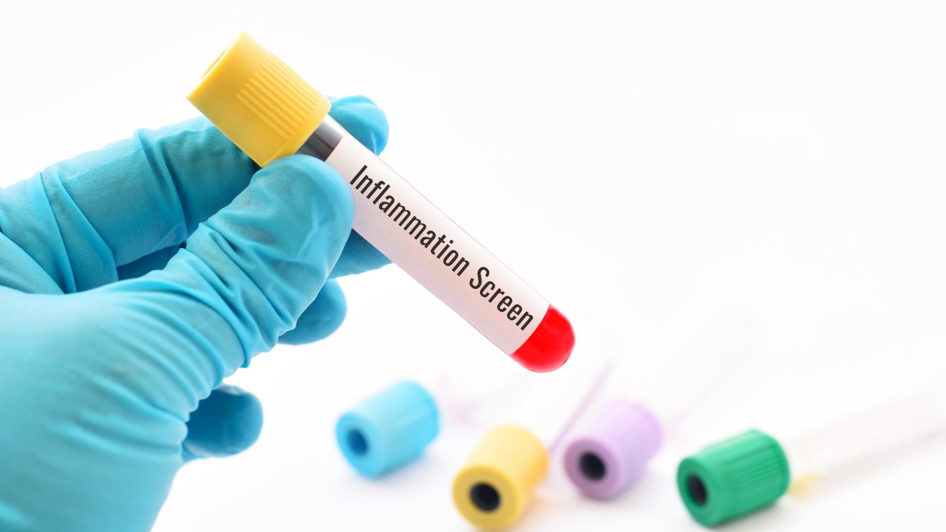 Inflammatory Markers – What CRP and ESR Reveal About Your Health ...