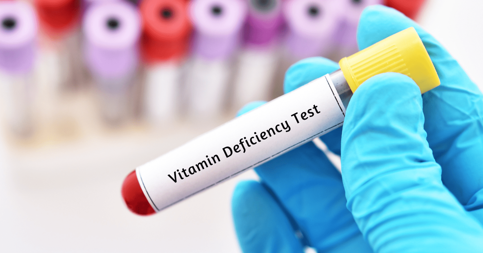 Why Vitamin D Deficiency Is More Common Than You Think - Marylebone ...