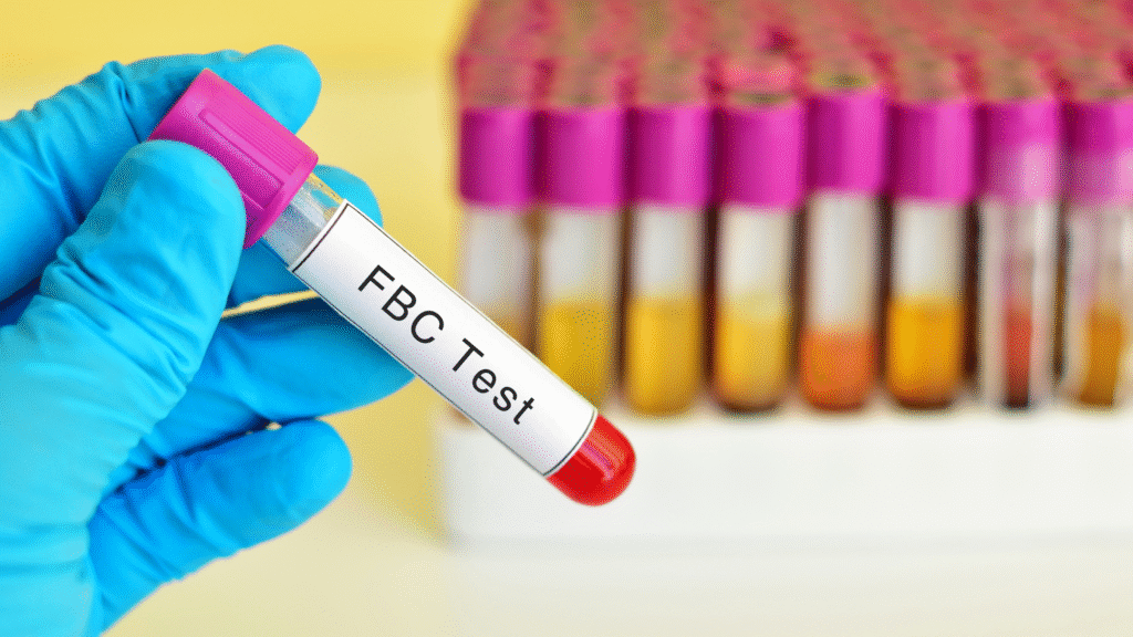 What is FBC? A Complete Guide to Full Blood Count Testing - Marylebone ...