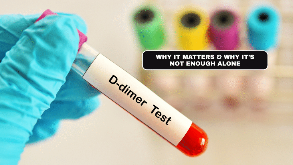 D-Dimer testing for Cardiovascular Health check in London | MDC