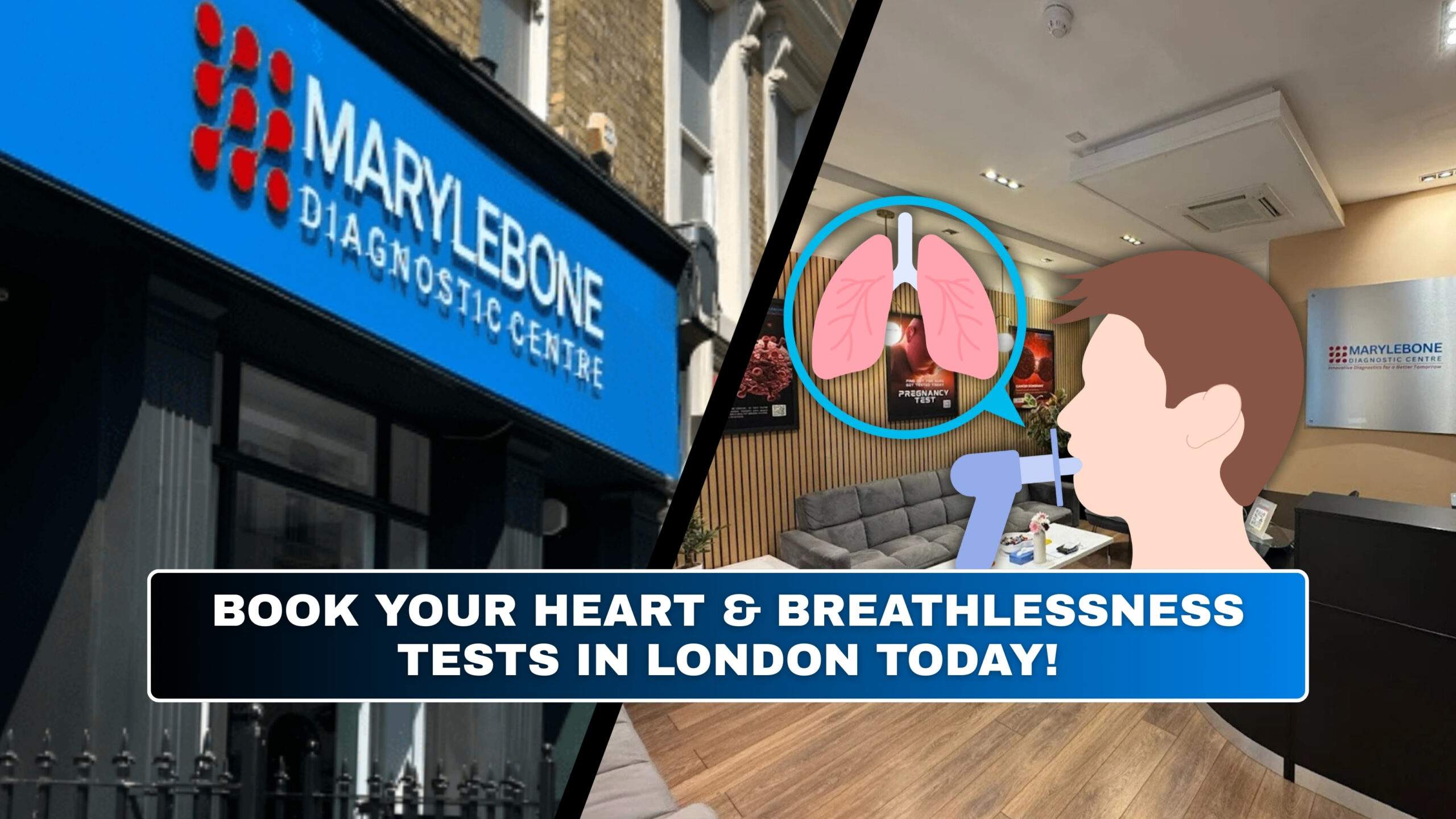 Breathlessness London | Heart Tests & NT-proBNP | MDC