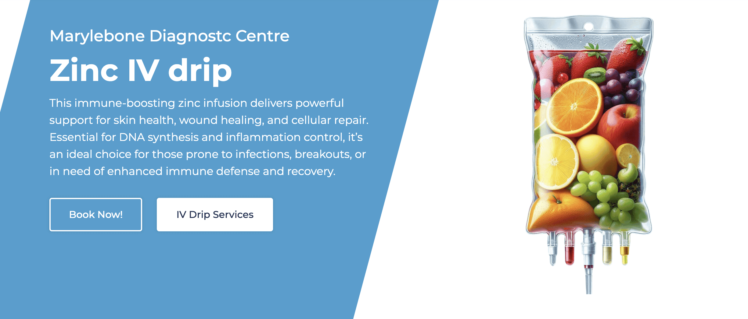 Zinc IV Drip - Benefits, Safety, Price & When to Book in London ...